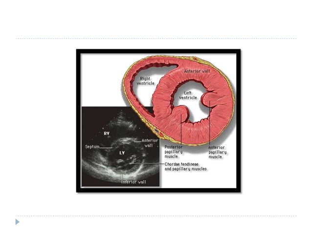 Echocardiogram | PPTX | Heart and Cardiovascular Diseases | Diseases ...