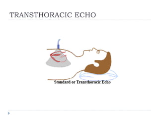 Echocardiogram | PPTX