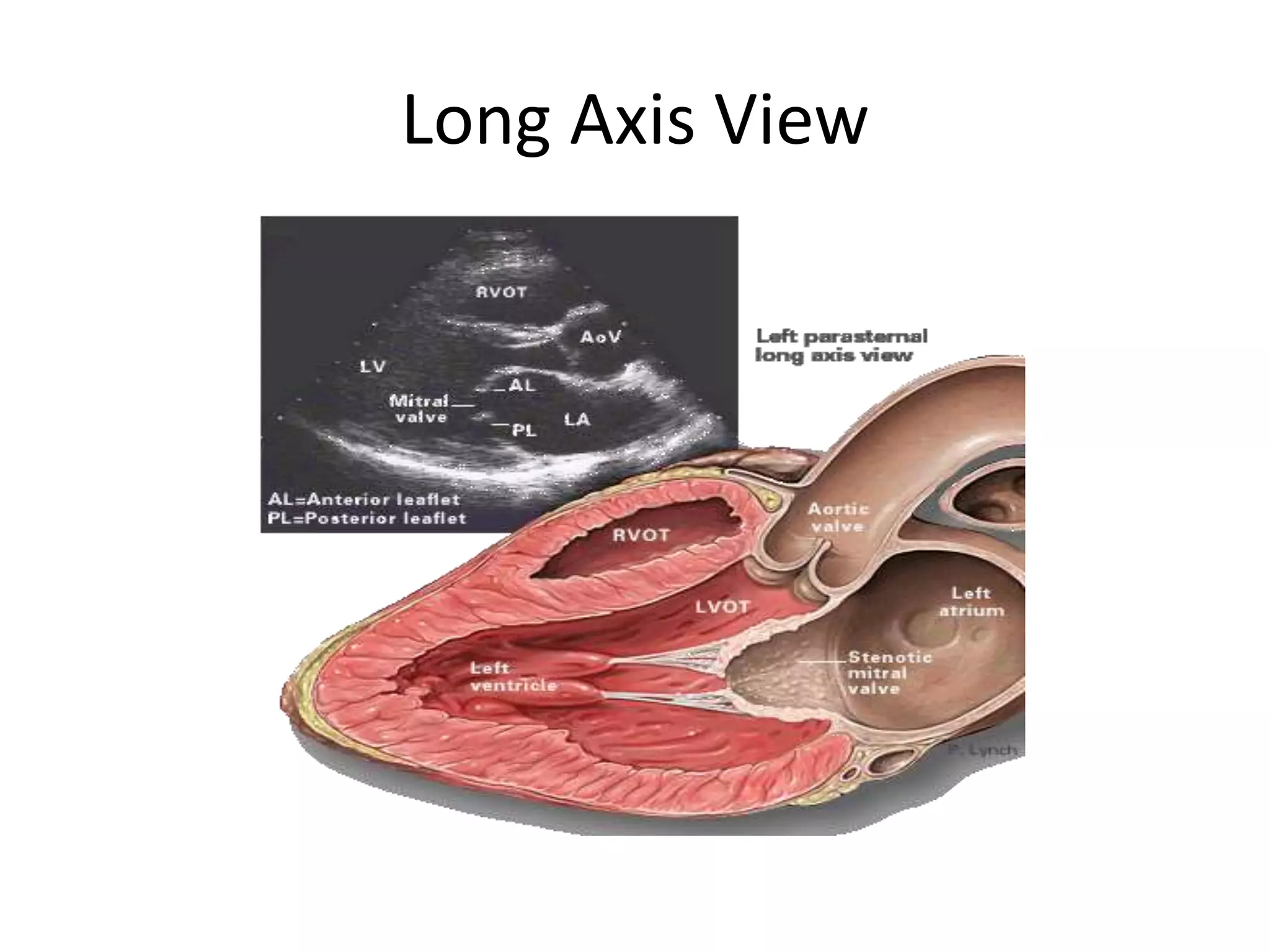 Echocardiogram acoustic windows | PPTX