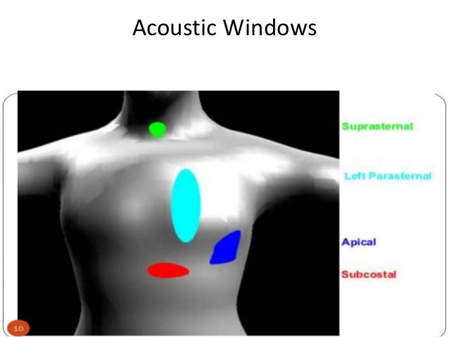 Echocardiogram acoustic windows