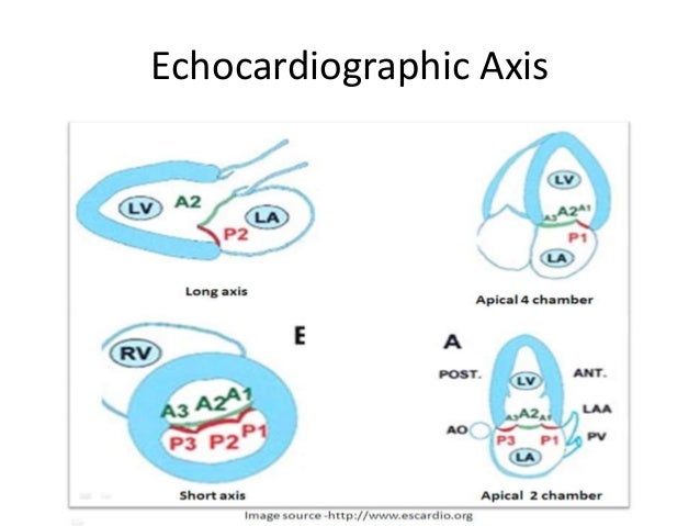 Echocardiogram acoustic windows