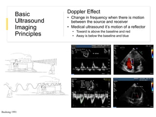 Echocardiogram Basics Iowa ACC CV Team 12-5-2020 1.pdf