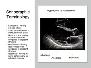 Echocardiogram Basics Iowa ACC CV Team 12-5-2020 1.pdf