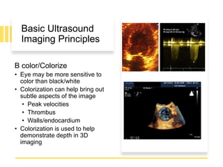 Echocardiogram Basics Iowa ACC CV Team 12-5-2020 1.pdf
