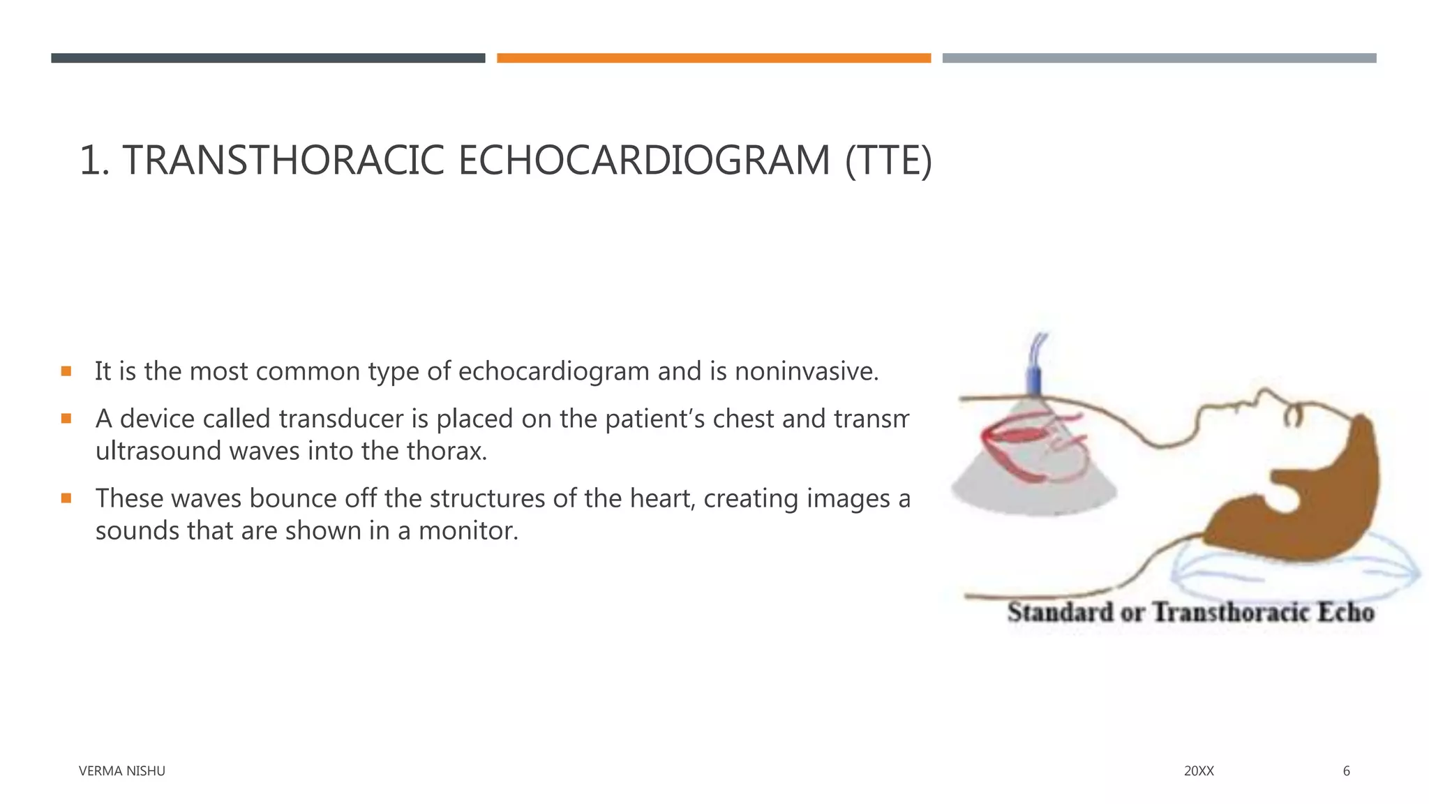 Echocardiogram or Echocardiography or Heart Ultrasound | PPTX