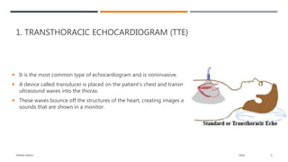 Echocardiogram or Echocardiography or Heart Ultrasound | PPT
