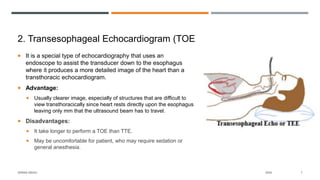 Echocardiogram or Echocardiography or Heart Ultrasound | PPT
