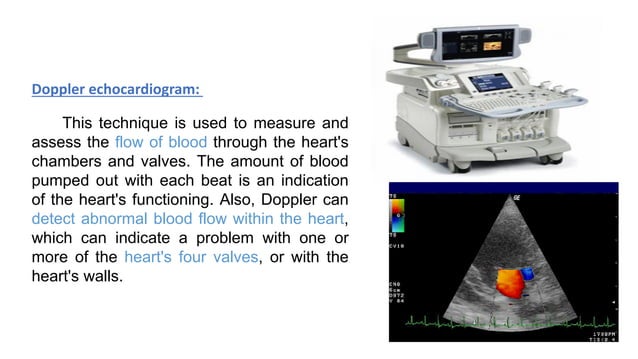 Echocardiogram intro & Types/ study of heart | PDF