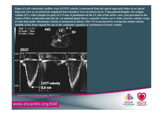 Echocardiographic assessment-valve-stenosis-slides | PDF