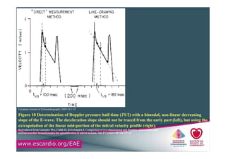Echocardiographic assessment-valve-stenosis-slides | PDF