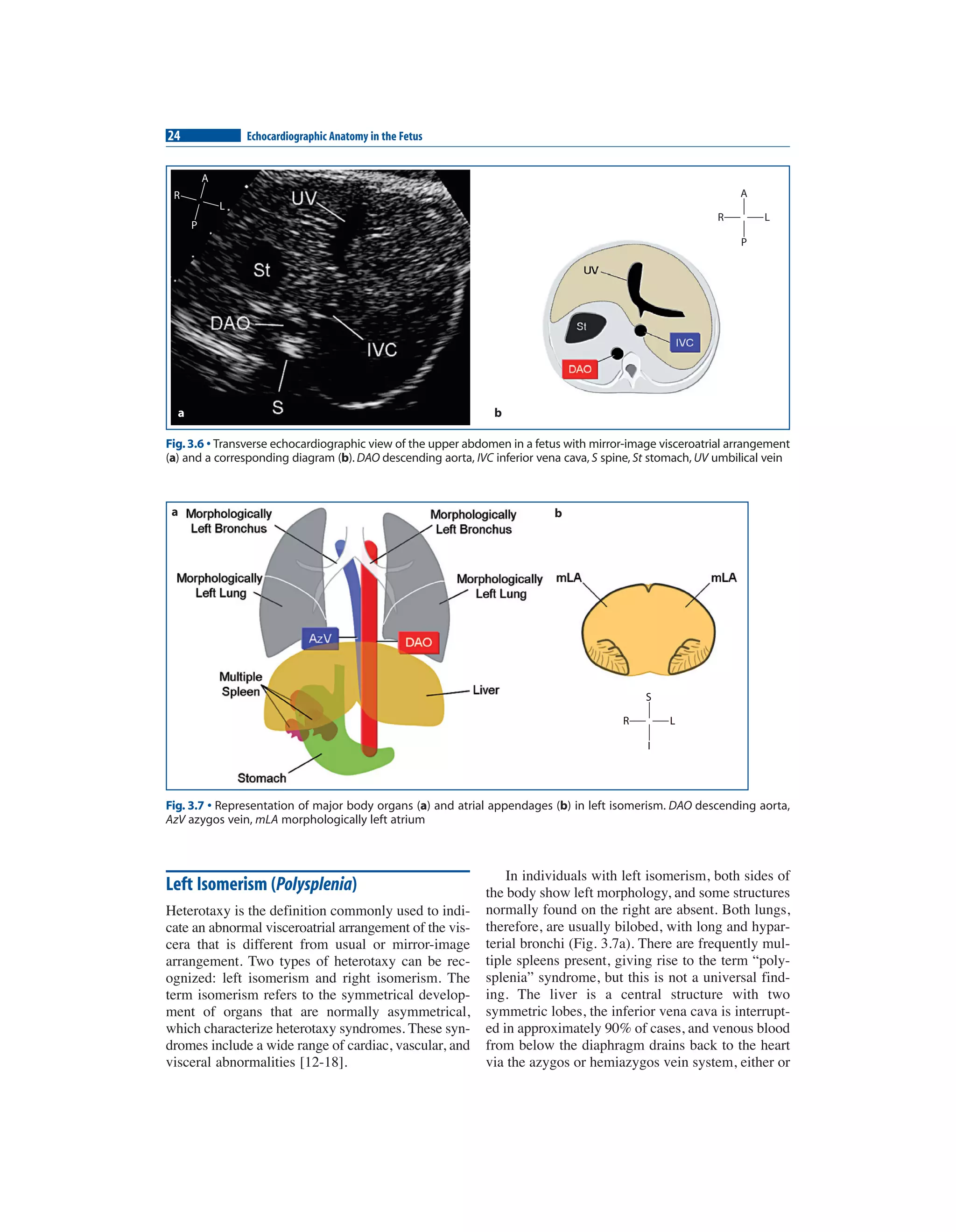 Echocardiographic anatomy in the fetus 2009 pg | PDF
