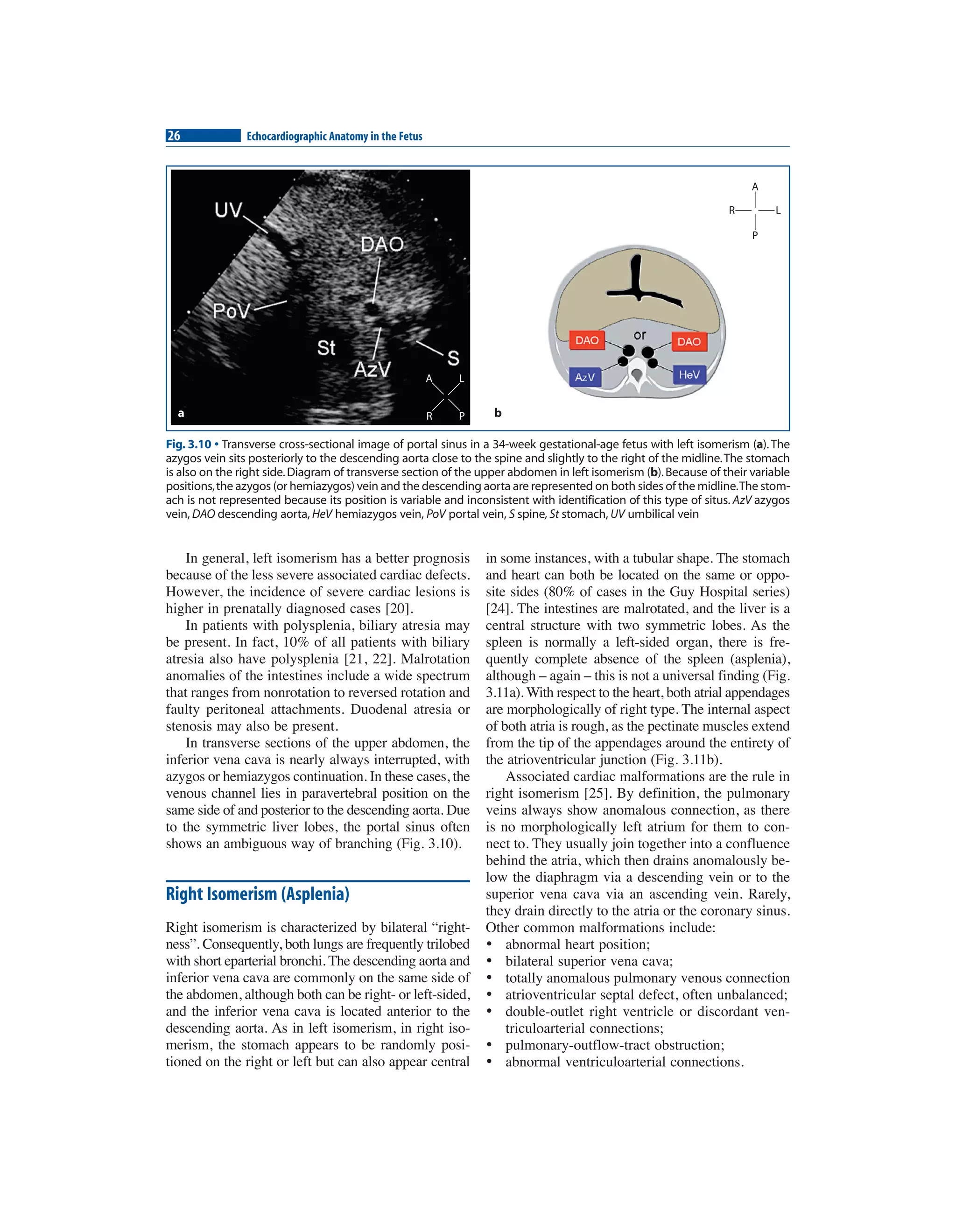 Echocardiographic anatomy in the fetus 2009 pg | PDF