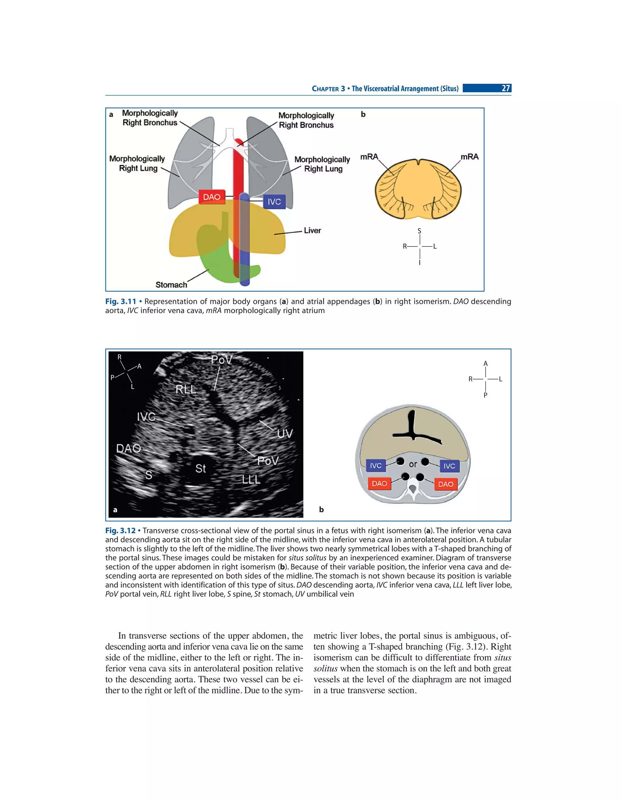 Echocardiographic anatomy in the fetus 2009 pg | PDF