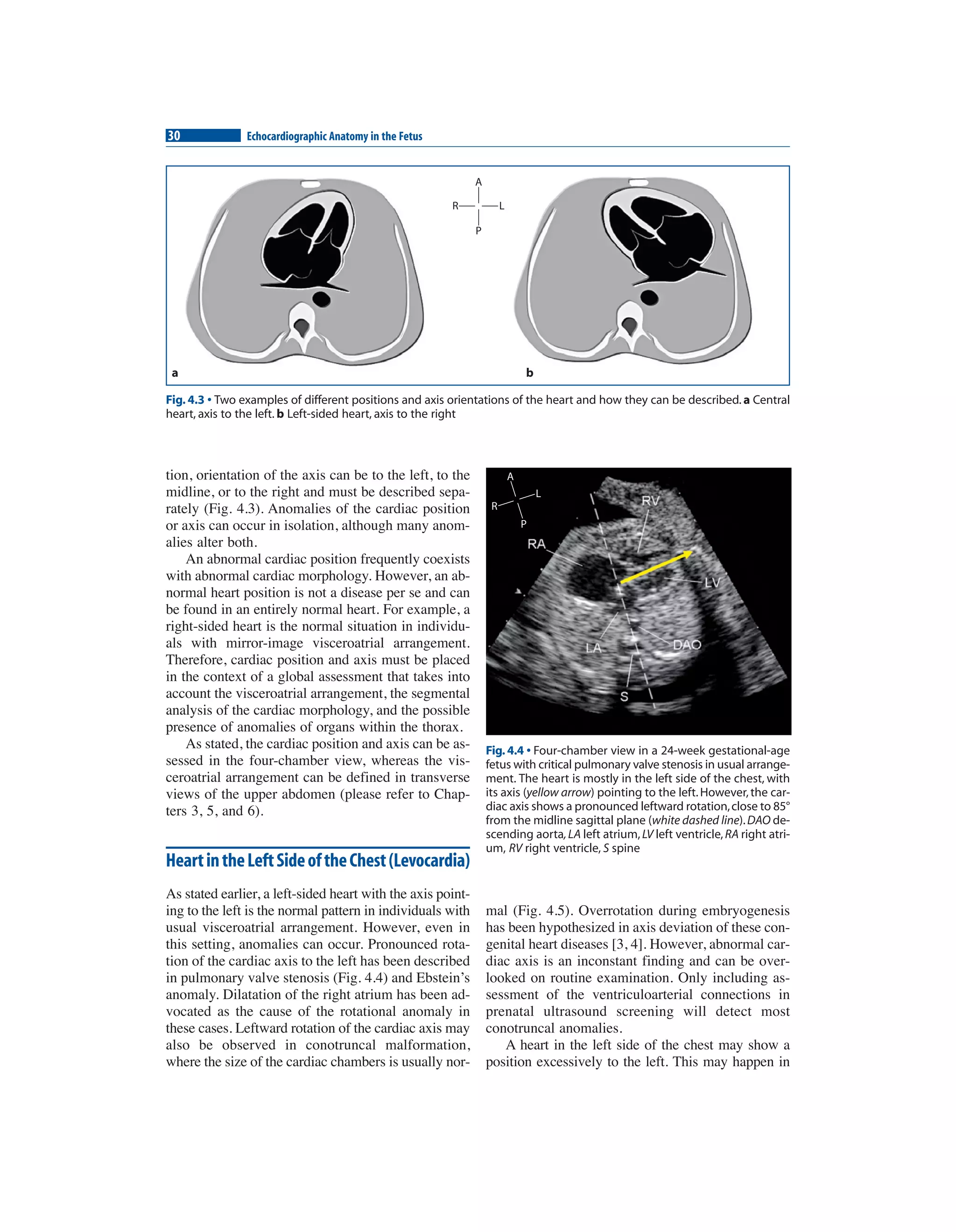 Echocardiographic anatomy in the fetus 2009 pg | PDF