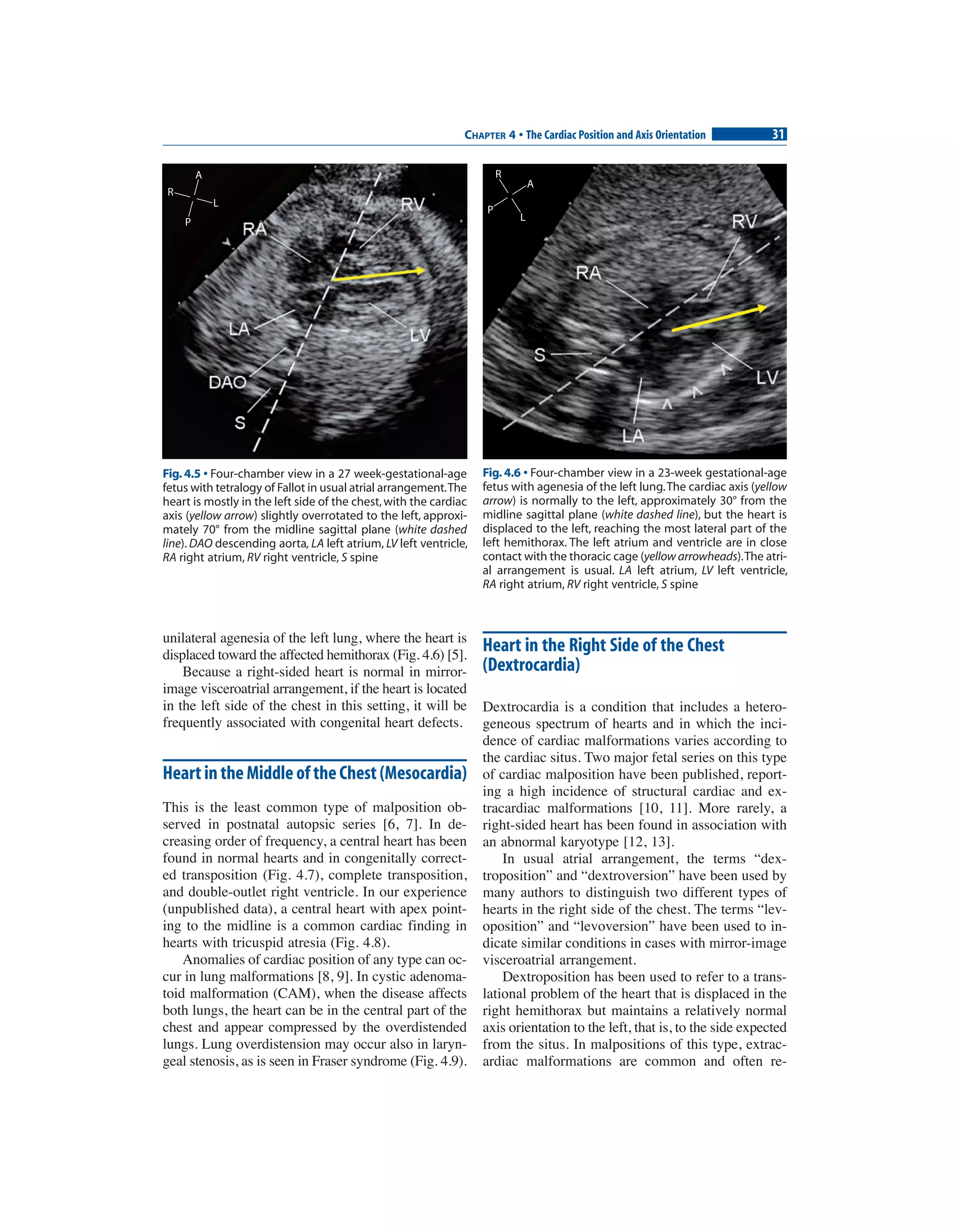 Echocardiographic anatomy in the fetus 2009 pg | PDF