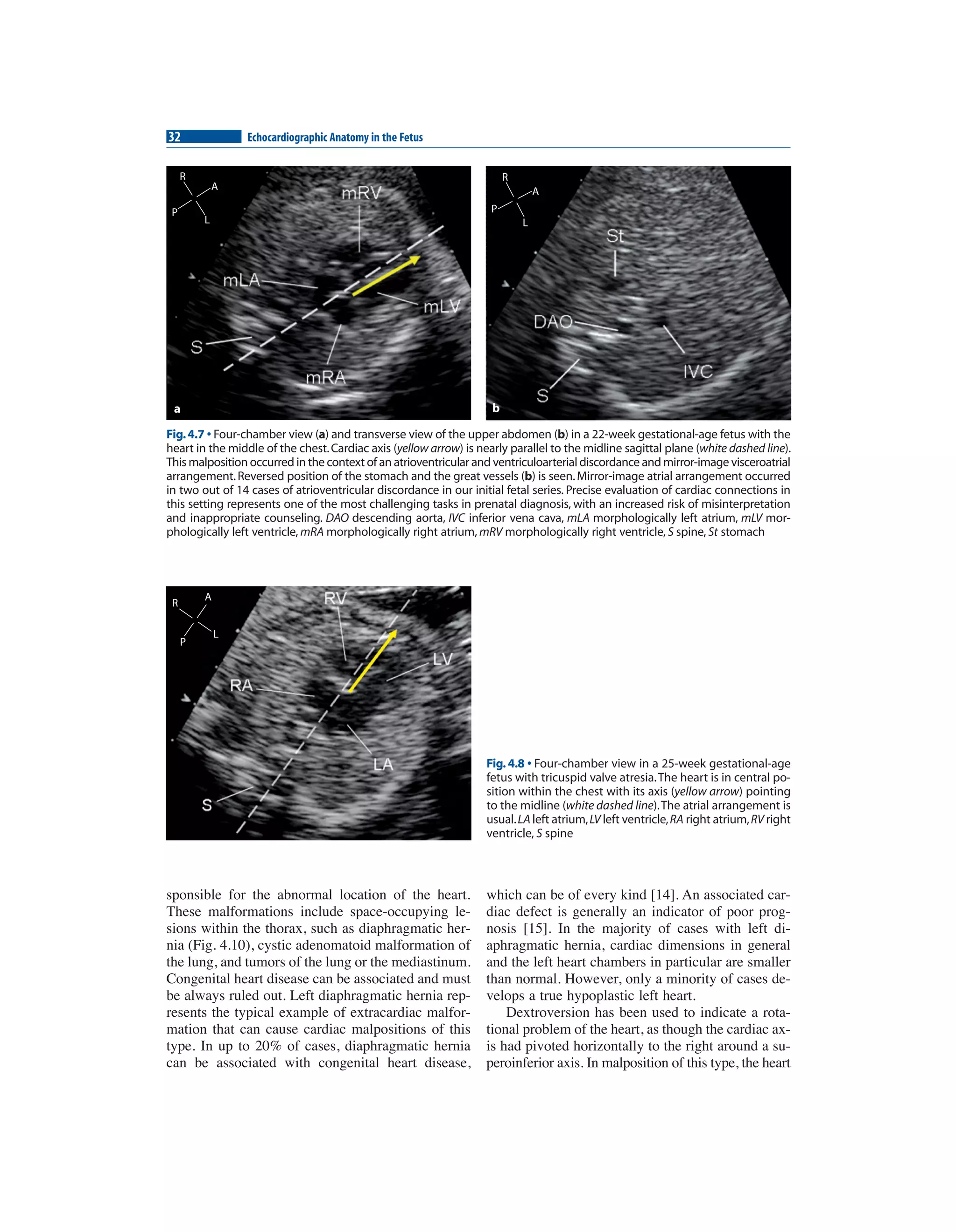 Echocardiographic anatomy in the fetus 2009 pg | PDF