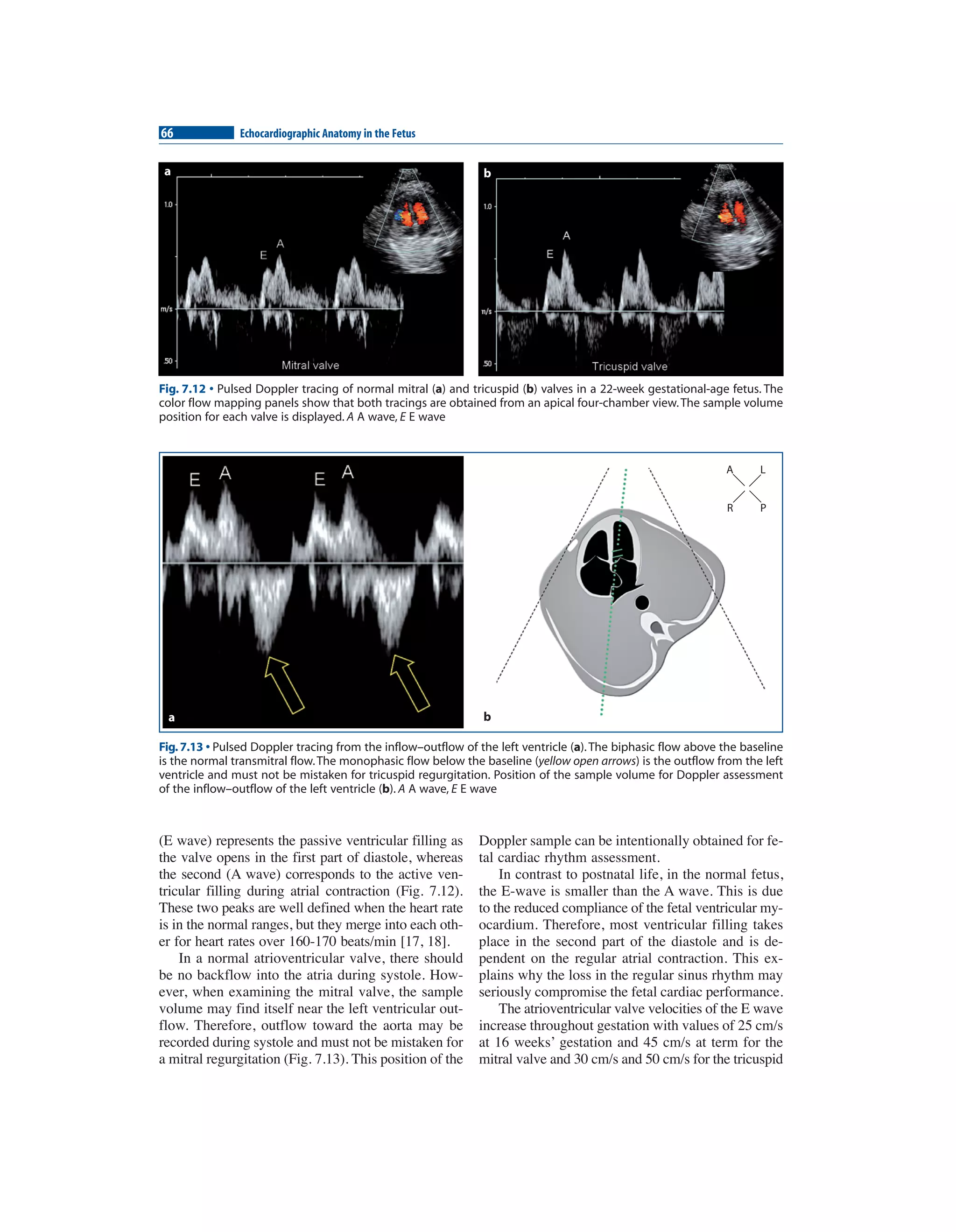 Echocardiographic anatomy in the fetus 2009 pg | PDF