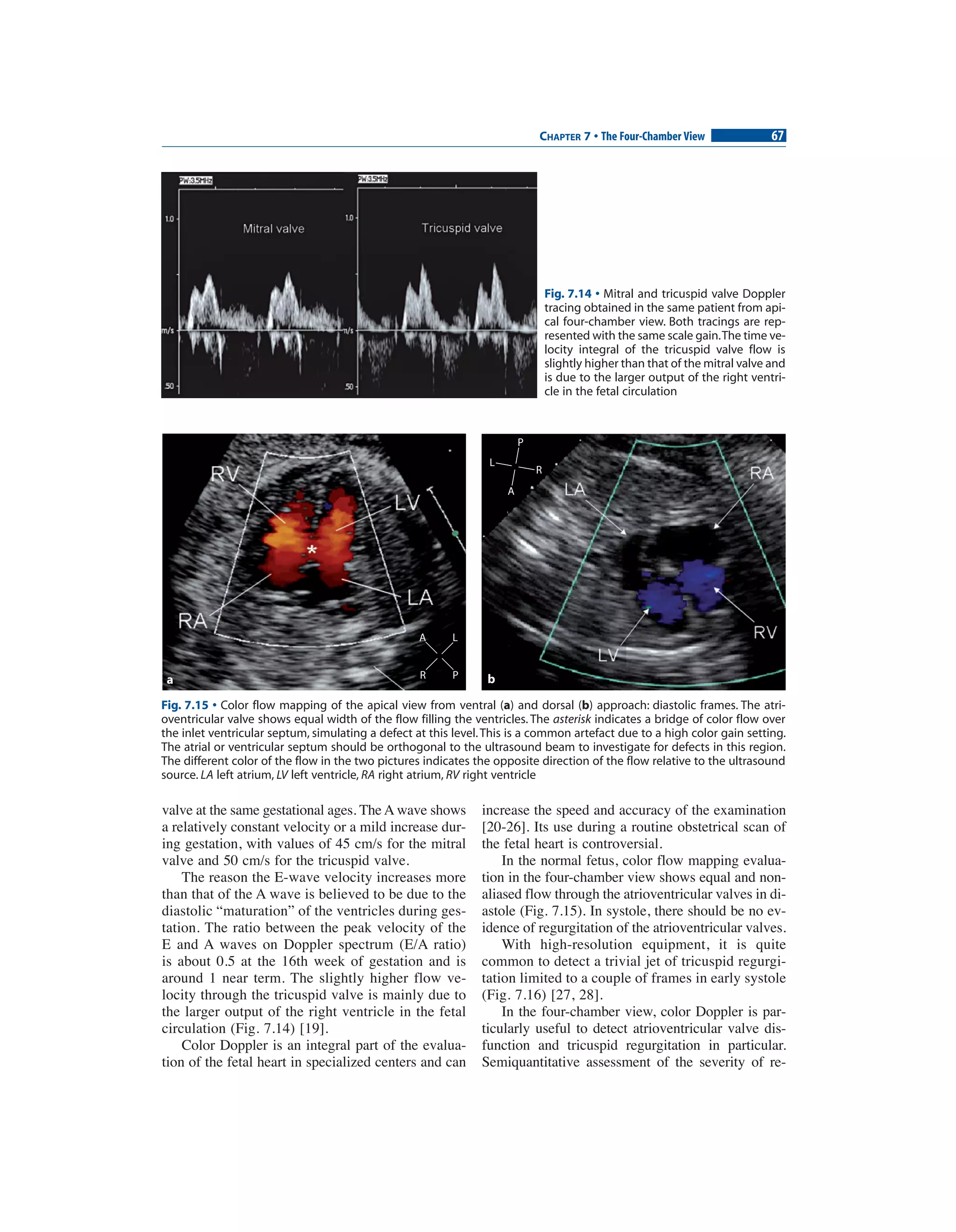 Echocardiographic anatomy in the fetus 2009 pg | PDF
