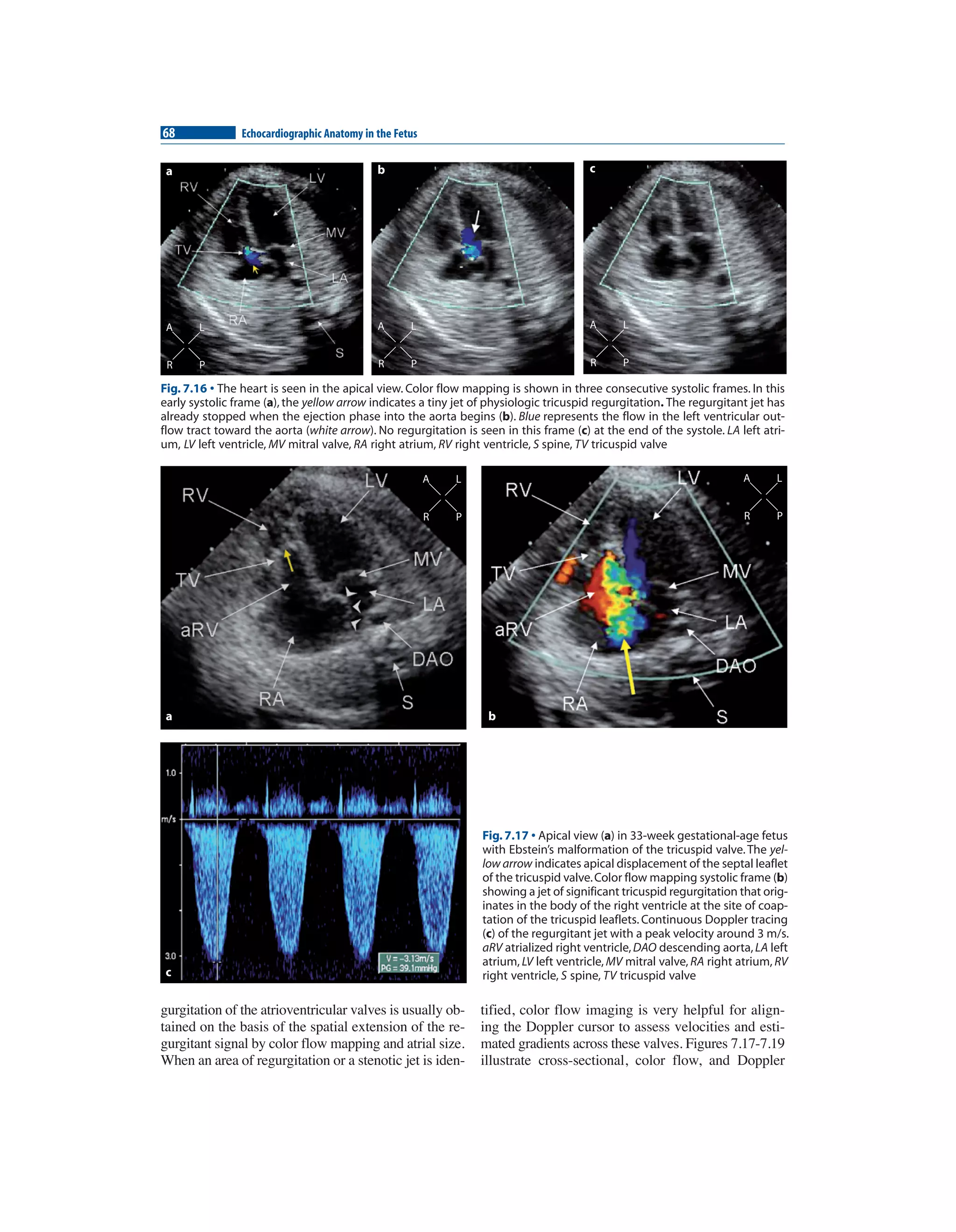 Echocardiographic anatomy in the fetus 2009 pg | PDF