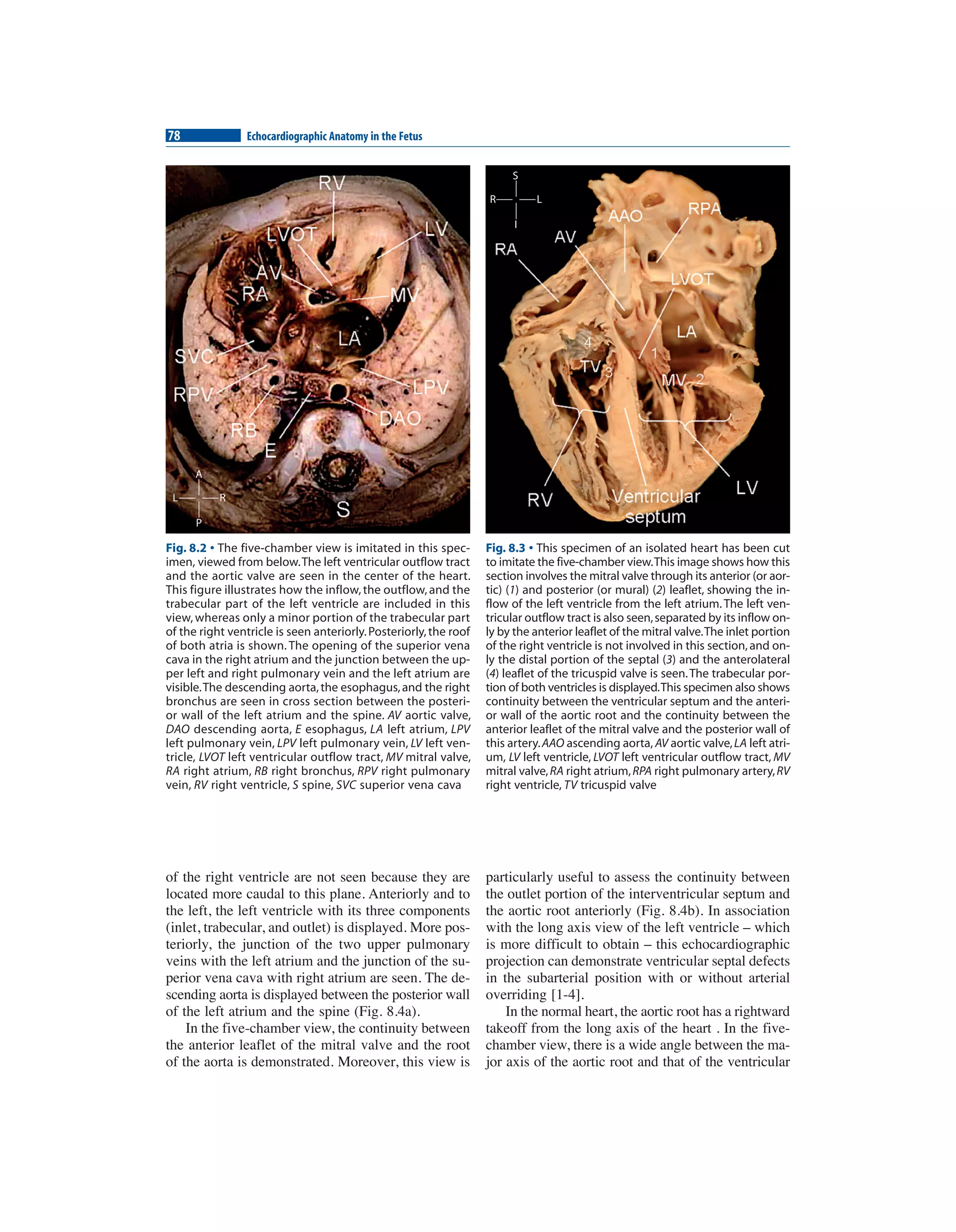 Echocardiographic anatomy in the fetus 2009 pg | PDF