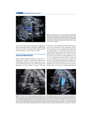 Echocardiographic anatomy in the fetus 2009 pg | PDF