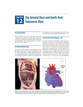 Echocardiographic anatomy in the fetus 2009 pg | PDF