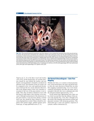 Echocardiographic anatomy in the fetus 2009 pg | PDF