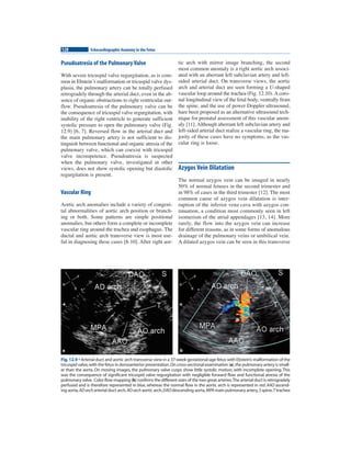 Echocardiographic anatomy in the fetus 2009 pg | PDF