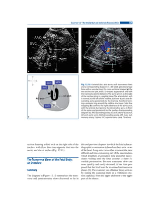 Echocardiographic anatomy in the fetus 2009 pg | PDF