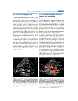 Echocardiographic anatomy in the fetus 2009 pg | PDF