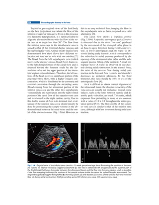 Echocardiographic anatomy in the fetus 2009 pg | PDF
