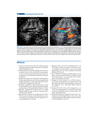 Echocardiographic anatomy in the fetus 2009 pg | PDF