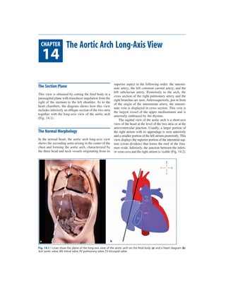 Echocardiographic anatomy in the fetus 2009 pg | PDF