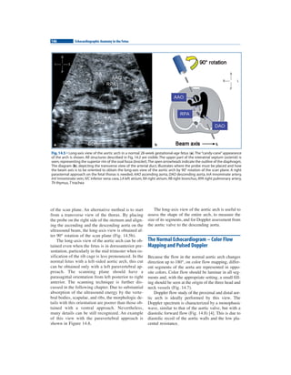 Echocardiographic anatomy in the fetus 2009 pg | PDF