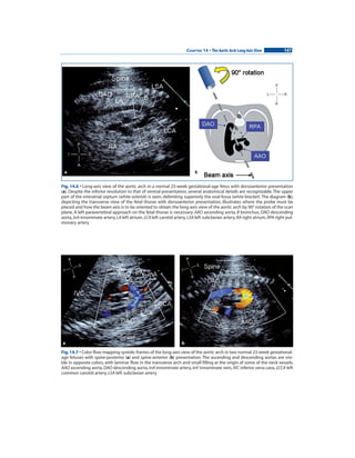 Echocardiographic anatomy in the fetus 2009 pg | PDF