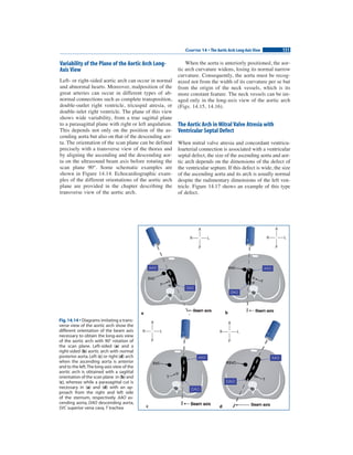 Echocardiographic anatomy in the fetus 2009 pg | PDF