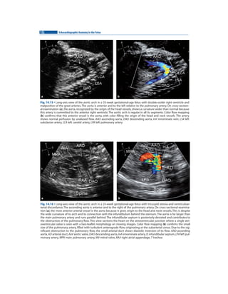 Echocardiographic anatomy in the fetus 2009 pg | PDF