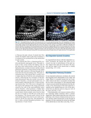 Echocardiographic anatomy in the fetus 2009 pg | PDF