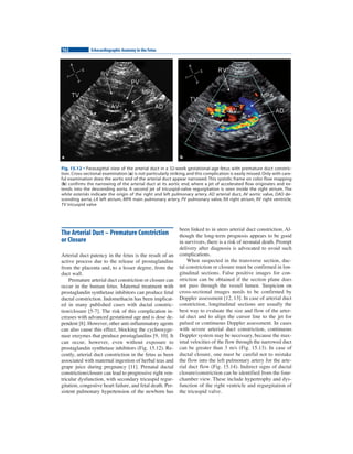 Echocardiographic anatomy in the fetus 2009 pg | PDF