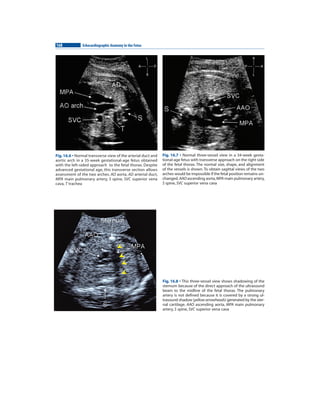 Echocardiographic anatomy in the fetus 2009 pg | PDF