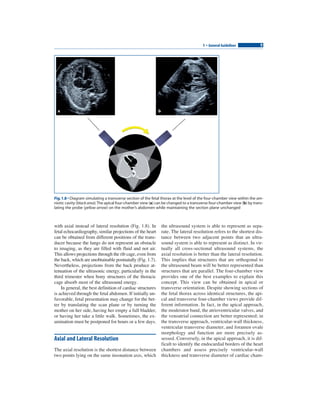 Echocardiographic anatomy in the fetus 2009 pg | PDF