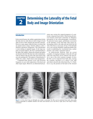 Echocardiographic anatomy in the fetus 2009 pg | PDF