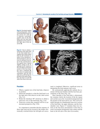 Echocardiographic anatomy in the fetus 2009 pg | PDF