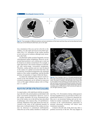 Echocardiographic anatomy in the fetus 2009 pg | PDF