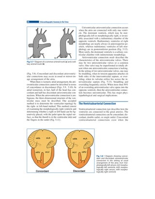 Echocardiographic anatomy in the fetus 2009 pg | PDF