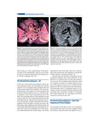Echocardiographic anatomy in the fetus 2009 pg | PDF