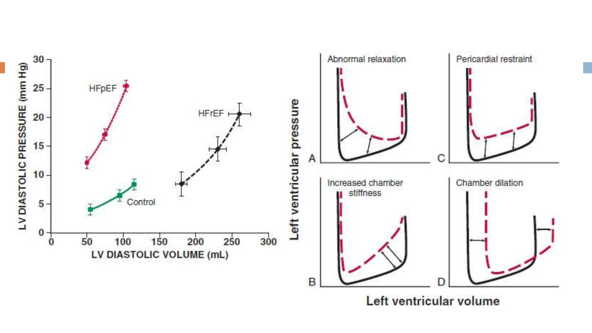 ECHOCARDIOGRAPHIC ASSESMENT OF DIASTOLIC FUNCTION.pptx