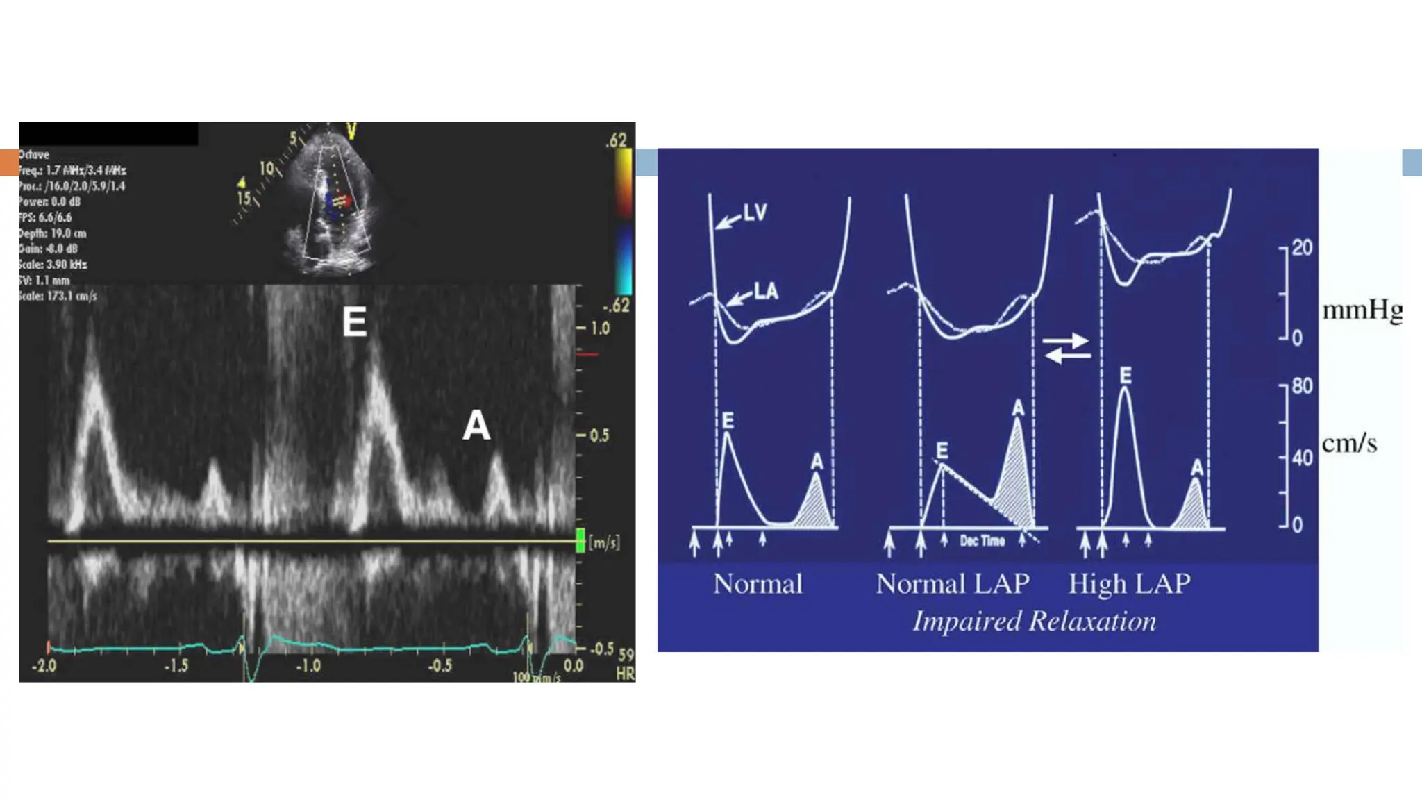 ECHOCARDIOGRAPHIC ASSESMENT OF DIASTOLIC FUNCTION.pptx