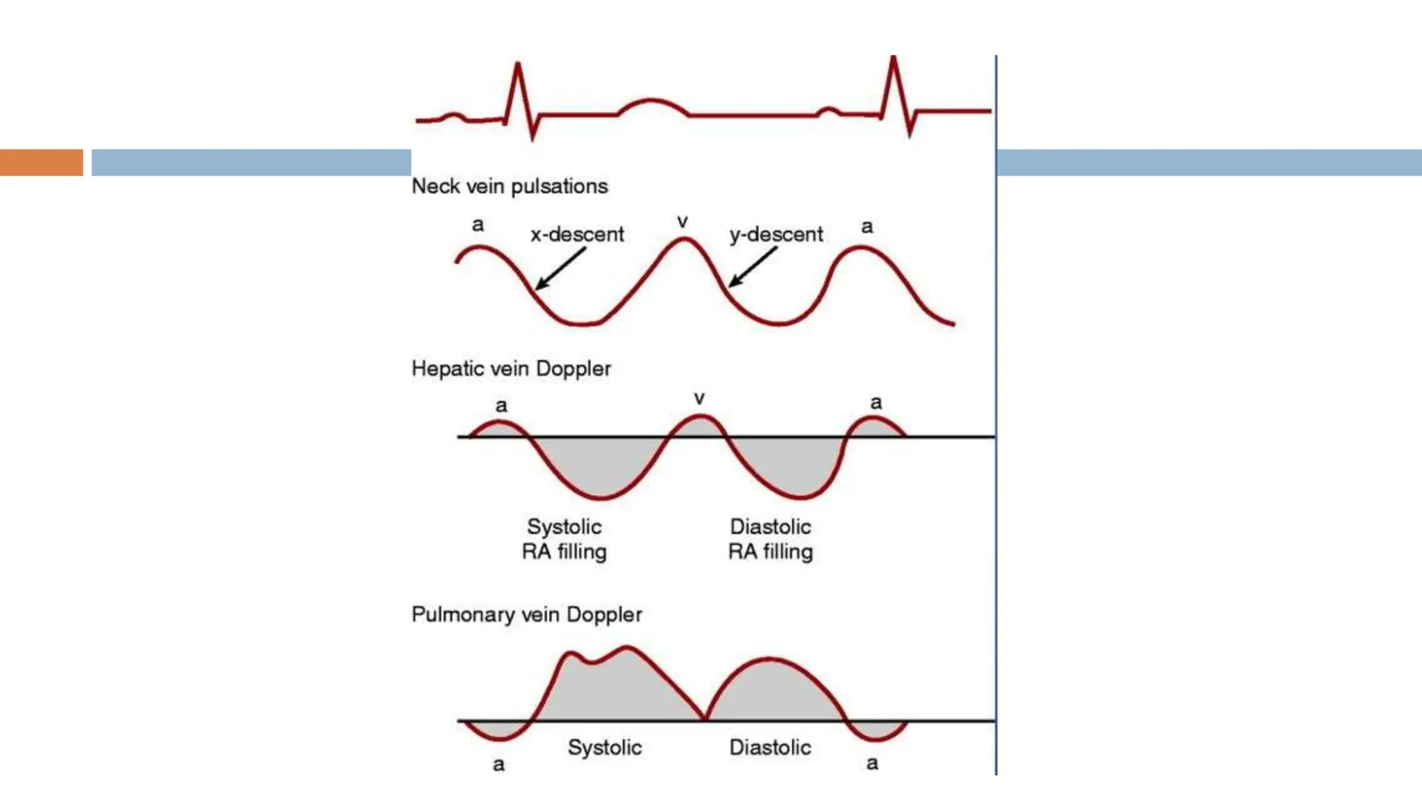 ECHOCARDIOGRAPHIC ASSESMENT OF DIASTOLIC FUNCTION.pptx