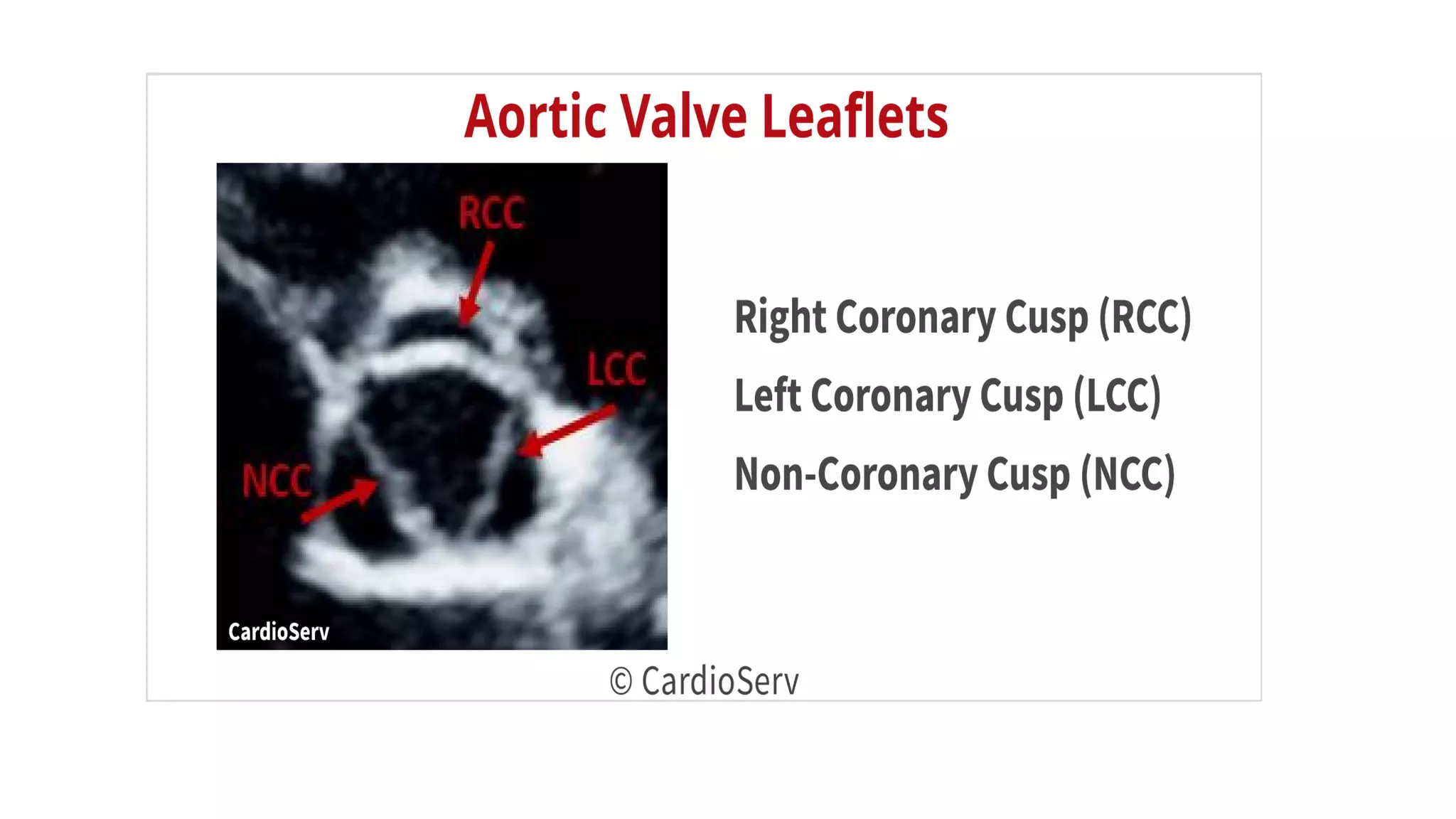 Echocardiographic evaluation of aortic valve and Aortic stenosis | PDF